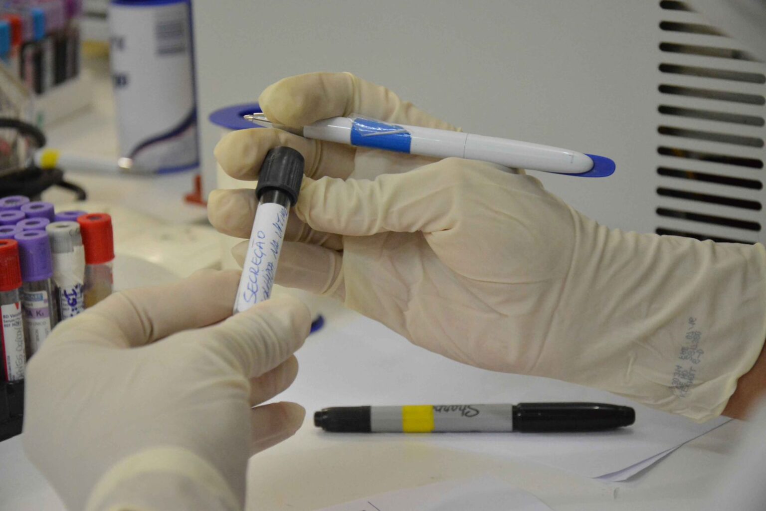 Amazonas é O 3ª Estado Que Mais Compartilha Perfis Genéticos De Restos ...